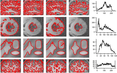 comparisons with local active contour model using a synthetic image and download scientific