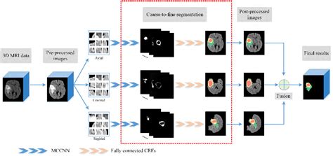 figure 1 from brain tumor segmentation using multi cascaded