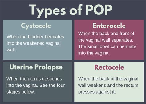 The Major Types Of Pelvic Organ Prolapse And Their Differences Vaginal