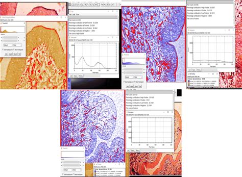 photomicrographs of vaginal luteal phase analyzed with imagej software download scientific