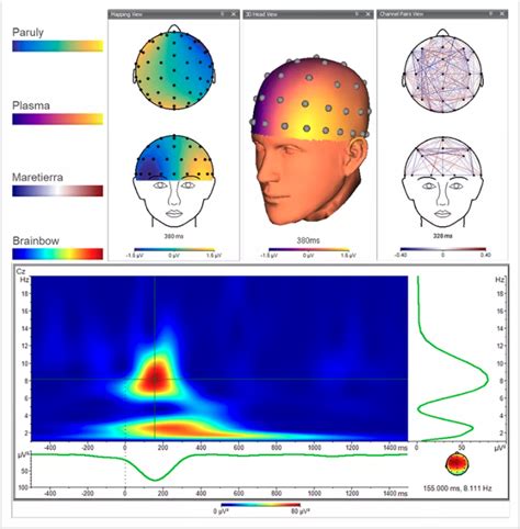 Eeg Data Analysis Connectivity Analysis Made Easy 555 Webp
