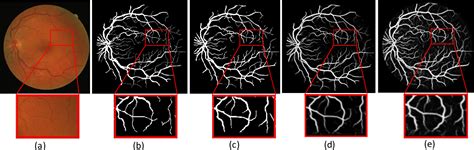 figure 9 from multi scale and multi branch convolutional neural network for retinal image