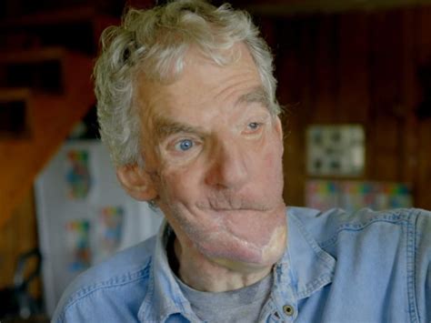 Man Who Had His Face Torn Off By A Bear Explains How He Survived I
