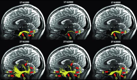 visual comparison of the tgns derived from the six tracking strategies download scientific