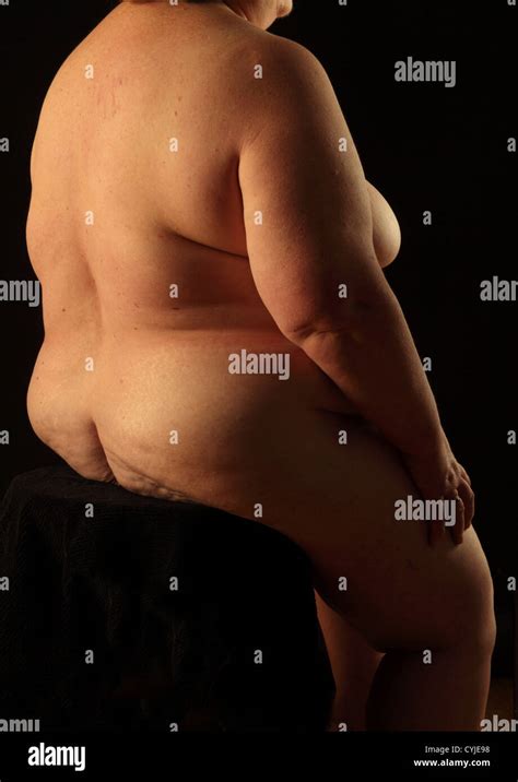 Femme Obese Nue Telegraph