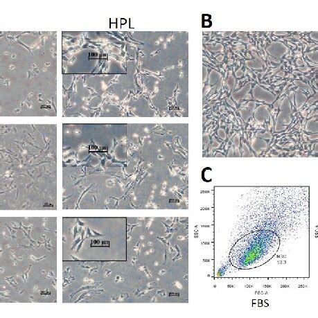 Morphological Characteristics Of Wharton S Jelly Mesenchymal Stem Cells