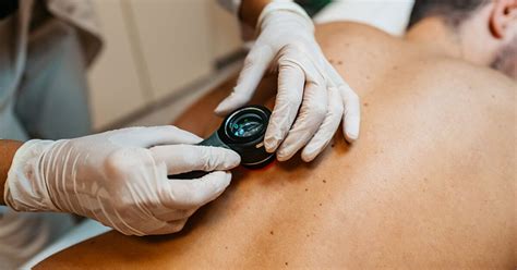 Seborrheic Keratosis Vs Actinic Keratosis What To Know