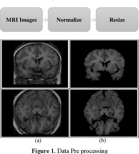 figure 1 from brain tumors classification using convolutional neural networks semantic scholar