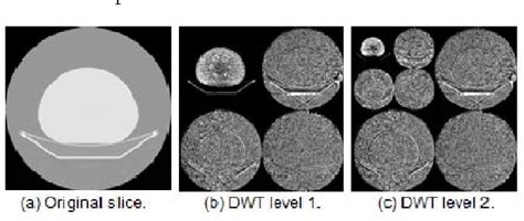 figure 2 from multi resolution analysis using curvelet and wavelet transforms for medical