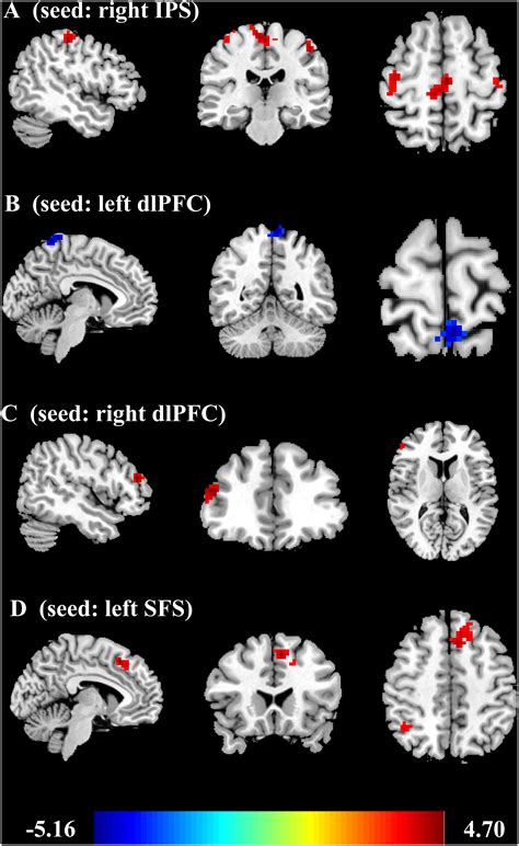 Frontiers The Different Brain Mechanisms Of Object And Spatial