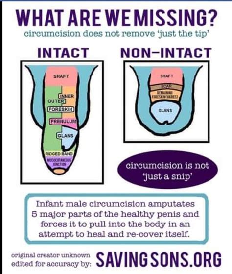 Circumcision Medical Anatomy Body Anatomy Anatomy And Physiology Sex Education Funny Clips