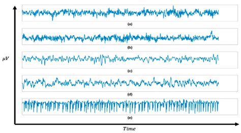 applied sciences free full text comparing eeg based epilepsy diagnosis using neural networks