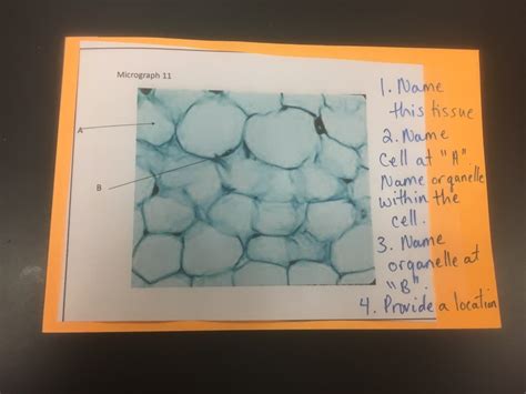 Adipose Tissue Diagram Quizlet