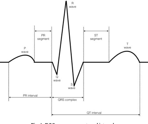 figure 1 from wavelet packet based algorithm for qrs region detection and r s wave