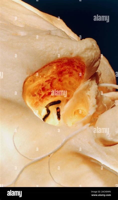 Skull Ear Cavity Anatomical Dissection Of The Left Hand Side Of The