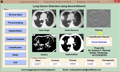 lung cancer detection using neural network matlab project with source code ~ matlab project codes