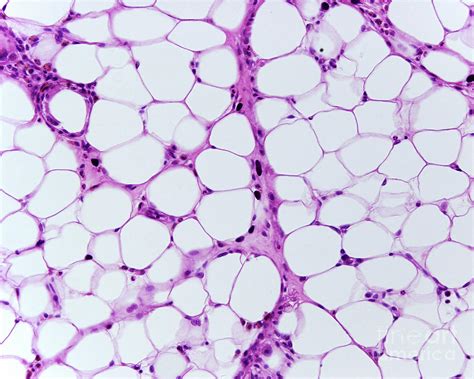 Adipose Tissue 1 By Science Photo Library