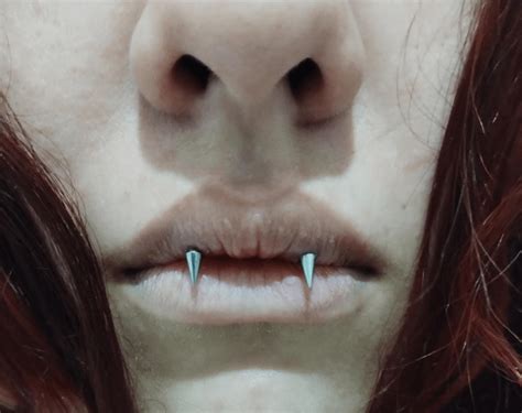 Healed Reverse Angel Fangsvampire Fangs By Ronaldo Sampaio At Ice Body Art Brazil No