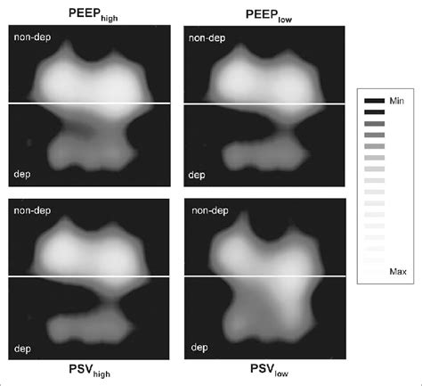 electrical impedance tomography image reconstruction of regional download scientific diagram