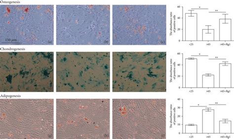 Differentiation Potential Of Human Bone Marrow Derived Mesenchymal Stem