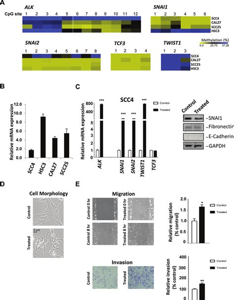 Reversal Of ALK Methylation In OSCC Cells Leads To Induction Of ALK