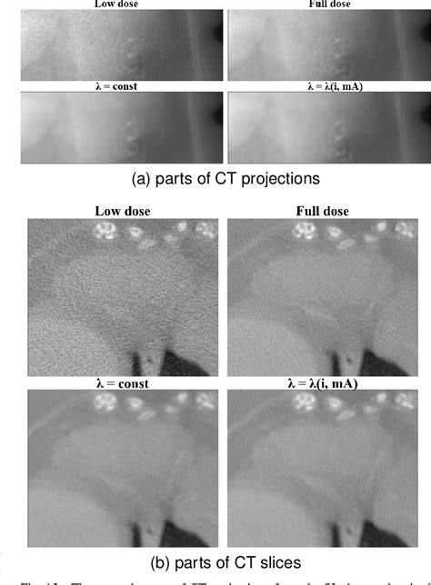figure 12 from self supervised physics based denoising for computed tomography semantic scholar