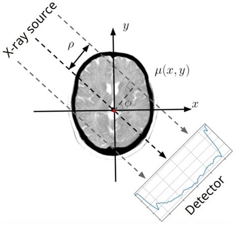 mathematics free full text tomographic reconstruction general approach to fast back