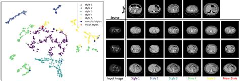 figure 4 from a novel 3d unsupervised domain adaptation framework for cross modality medical