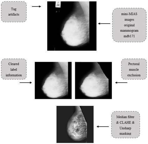 diagnostics free full text a novel medical image enhancement algorithm for breast cancer