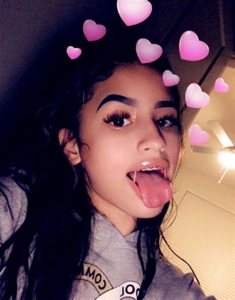 Pin Iamsunny00👑 Cute Girls With Braces Braces Girls Cute Braces