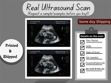Pin On Fake Ultrasound Picture