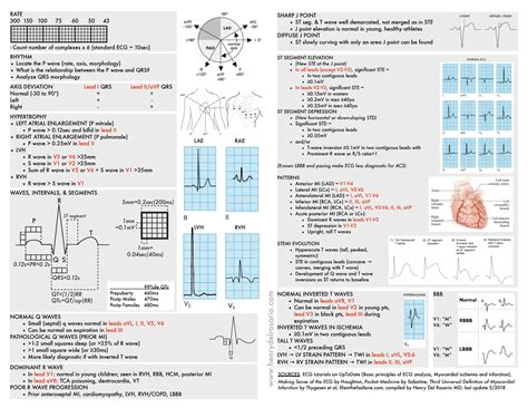 Handy ECG Reference Cheatsheet Clinical R Medicalschool