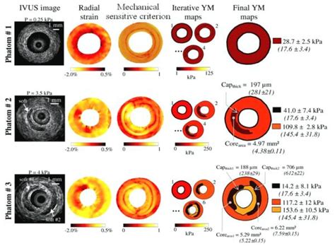model based elastography a survey of approaches to the inverse elasticity problem abstract
