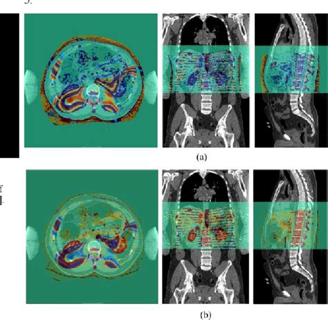 [pdf] colorization of the visible human images semantic scholar