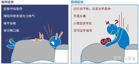 一分钟检测你睡眠呼吸暂停综合征的机率 知乎