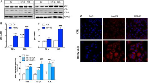 Frontiers Lipophagy Impairment Is Associated With Disease Progression
