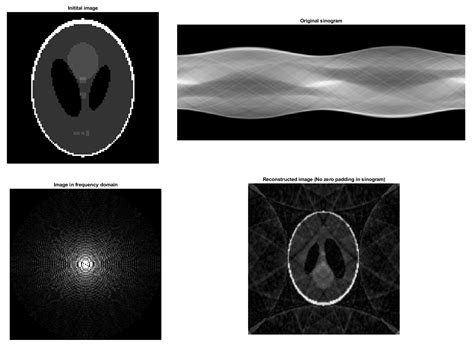[best answer] implementing a filtered backprojection algorithm using the central slice theorem