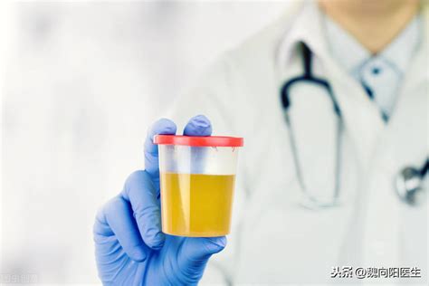 尿常规化验单怎么看尿路感染如何从尿常规判断尿路感染手把手教你读化验之7 说明书网