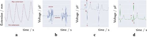biosignals learning and synthesis using deep neural networks biomedical engineering online