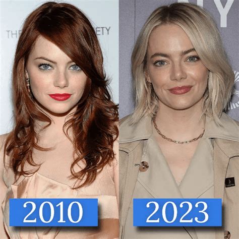 Emma Stone Plastic Surgery Before And After