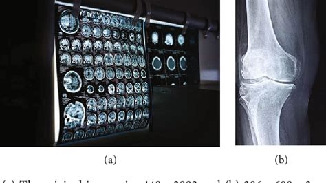 figure 1 from convergence analysis of a modified forward backward splitting algorithm for