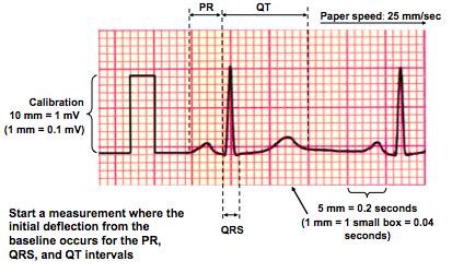 QUIZ 2 CONDUCTION SYSTEM OF HEART Flashcards Quizlet