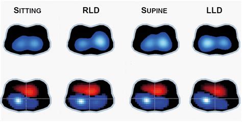 axial electrical impedance tomography eit imaging performed in four download scientific
