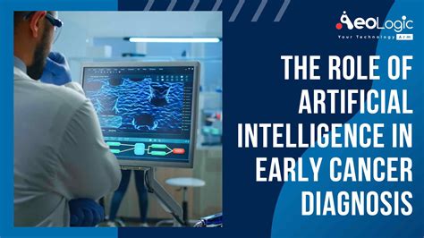 the role of artificial intelligence in early cancer diagnosis aeologic blog