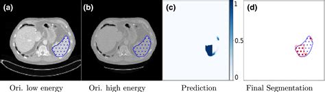 automatic multi‐organ segmentation in dual‐energy ct dect with dedicated 3d fully