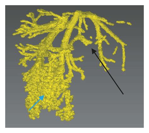 comparison of the improved fuzzy connectedness fc method with download scientific diagram