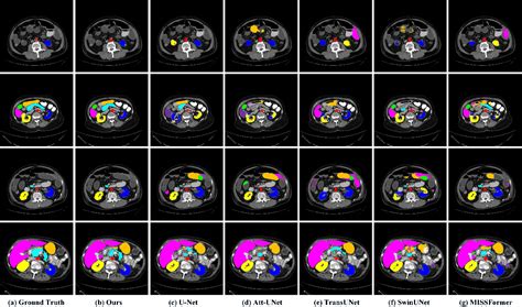 figure 2 from i2 net intra and inter scale collaborative learning network for abdominal multi