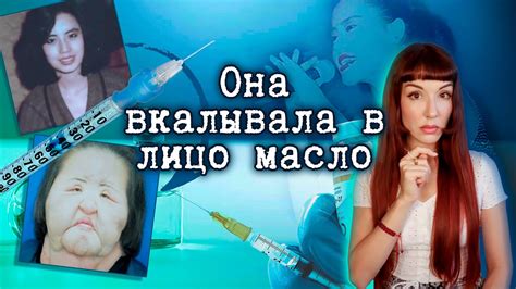 Она вкалывала себе в лицо соевое масло герметик и цемент Youtube