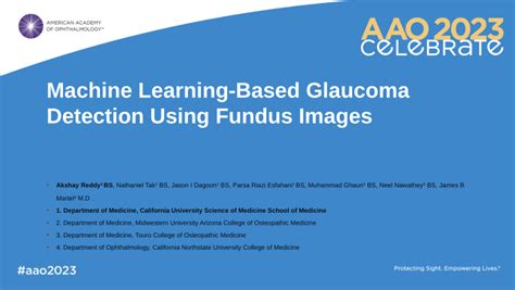 pdf machine learning based glaucoma detection using fundus images aao 2023