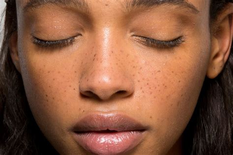 Pick Up Line About Freckles At Weblucablog Blog